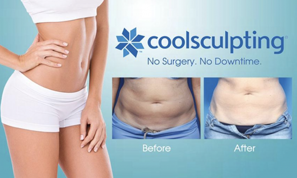 Freeze Fat This Winter with CoolSculpting - International Beauty Institute